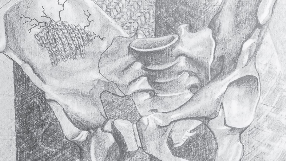 How bacteria and textile fibres can heal bones - University of Borås
